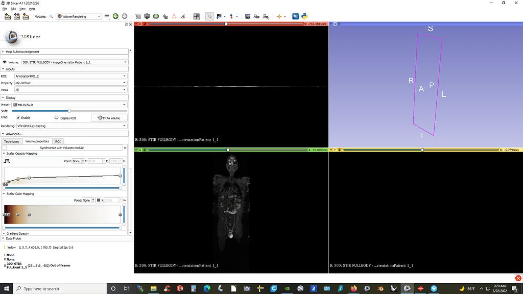 Loaded volume data showing as one slice, cant render volume - Support ...