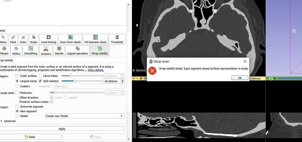 Wrap Solidify error - Support - 3D Slicer Community