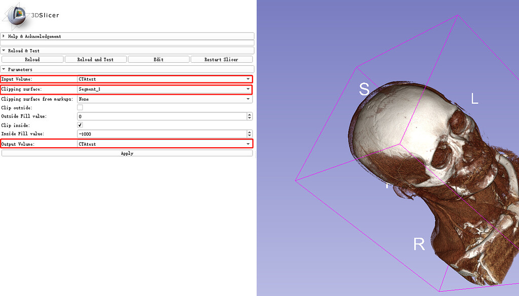 How To Get Current Volume And Segment In Python Development 3d Slicer Community