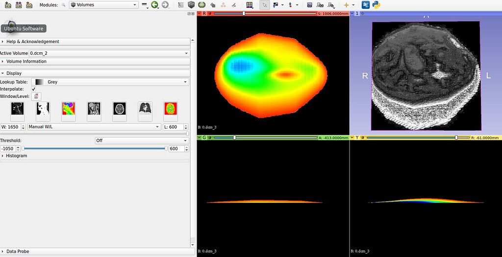 Volume rendering shows grayscale even if RGB dicom is loaded - Support ...