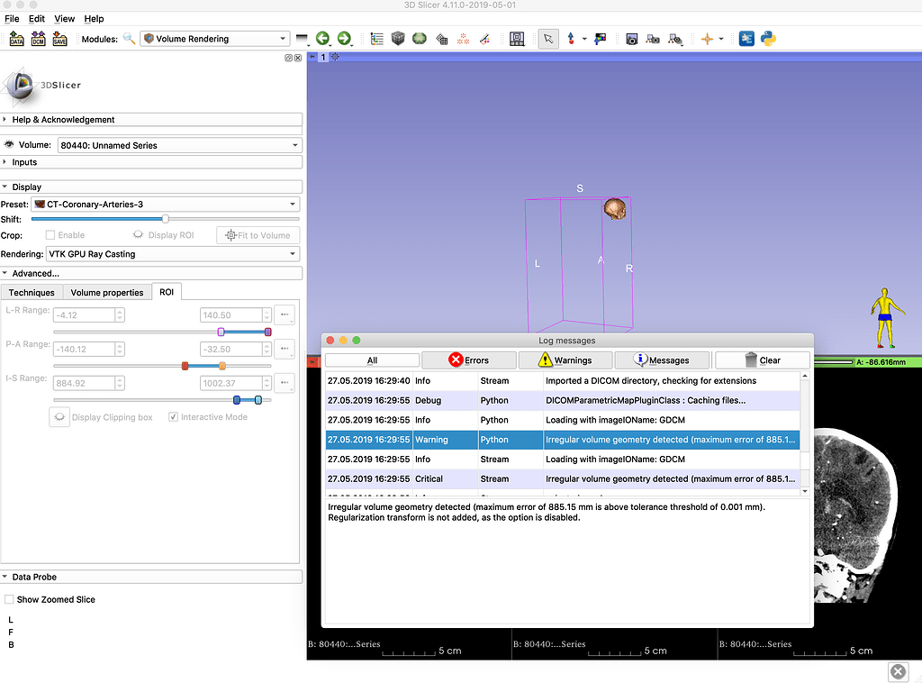 Problem in Volume Rendering - Support - 3D Slicer Community