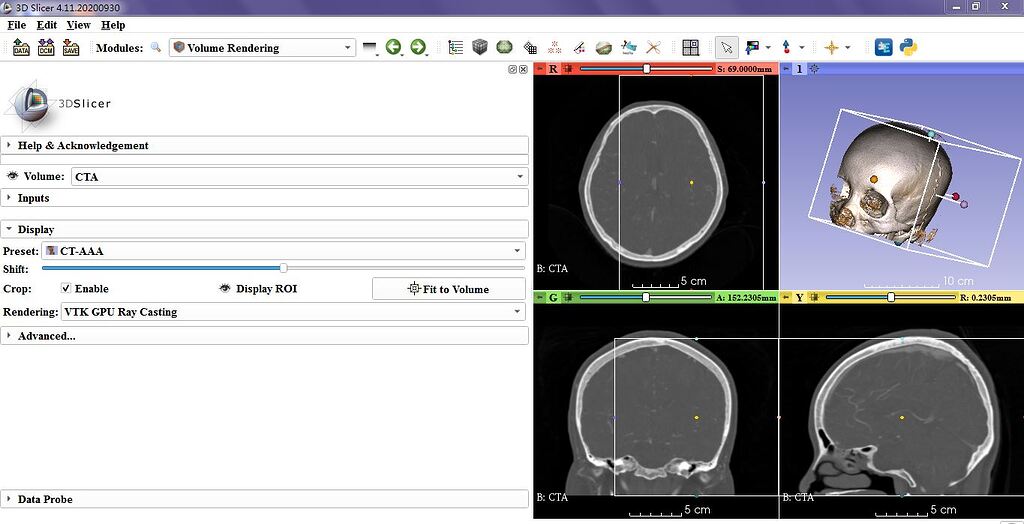 How to adjust the ROI - Community - 3D Slicer Community