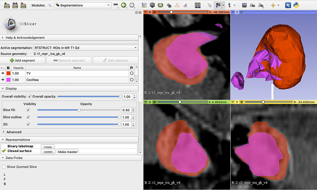 Clarification re RTSTRUCT display - Support - 3D Slicer Community