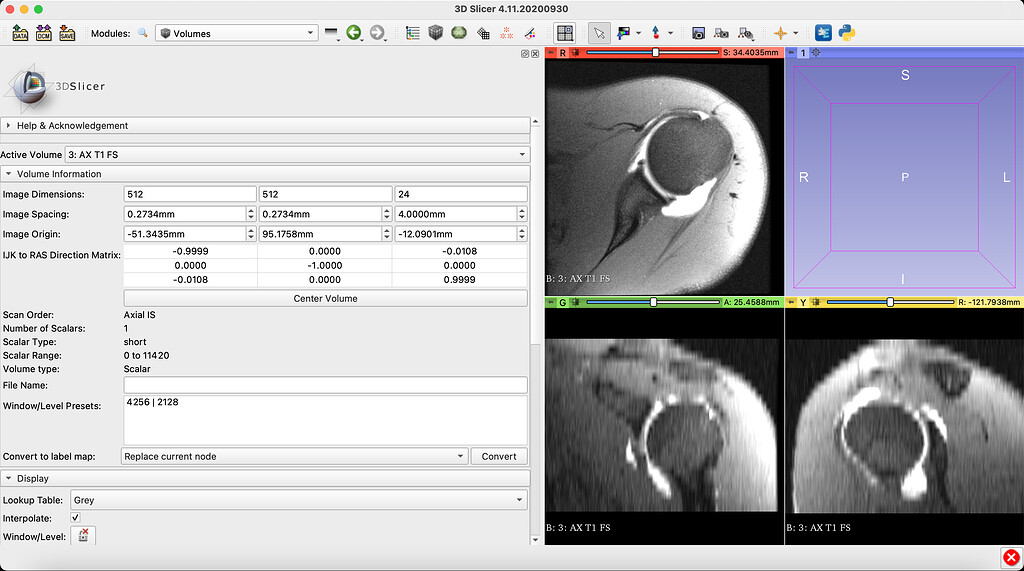 Distorted Images from DICOM File - Support - 3D Slicer Community