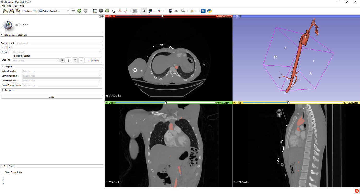 New module: Extract Centerline (in SlicerVMTK extension) - Support - 3D ...