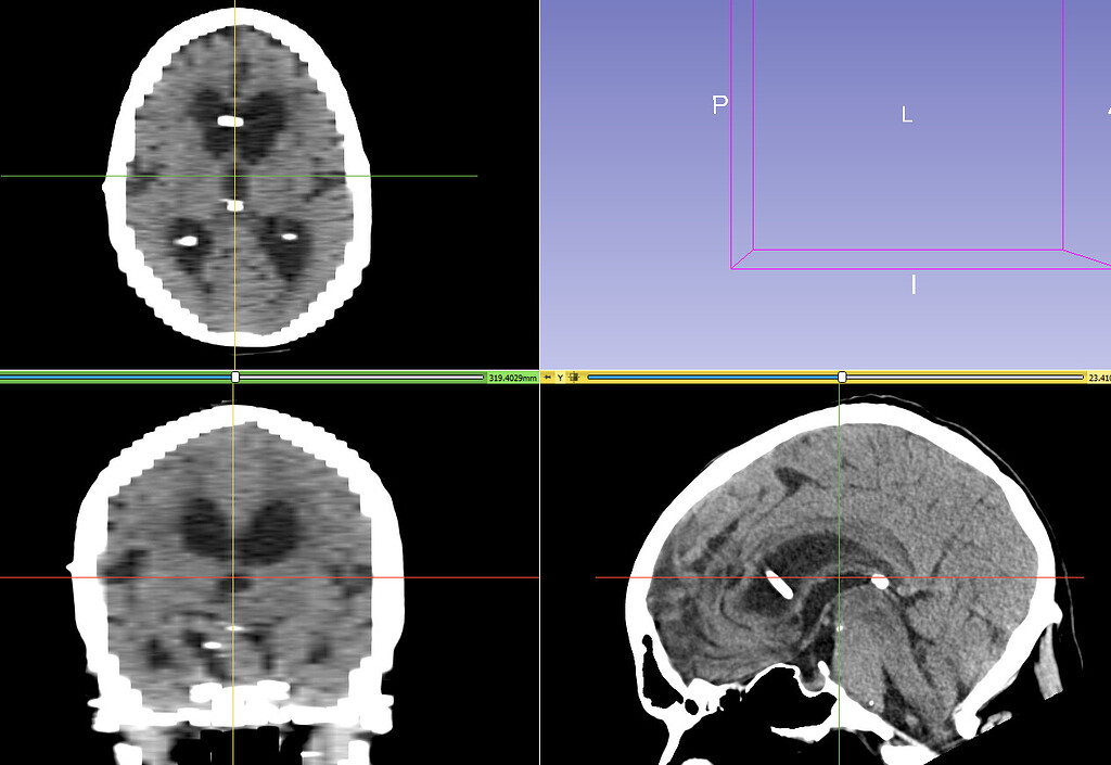 Slice view orientation of oblique/rotated volumes - aligned to volume ...