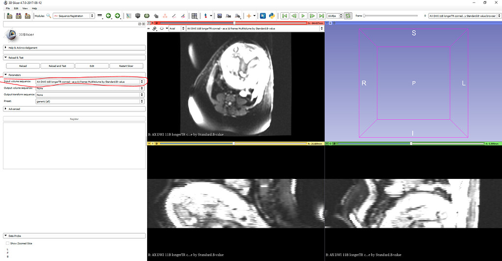 To install extension "Sequence registration" - Support - 3D Slicer Community