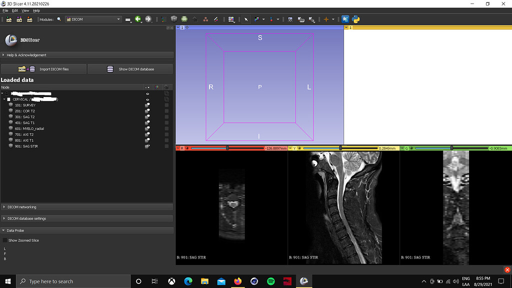 Failing loading scalar volume warning it was given as seen at the ...