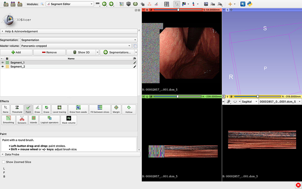 Error Importing Endoscopy Image Snapshots Support 3d Slicer Community