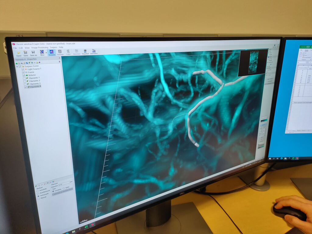 Segmentation from volume rendering - Support - 3D Slicer Community