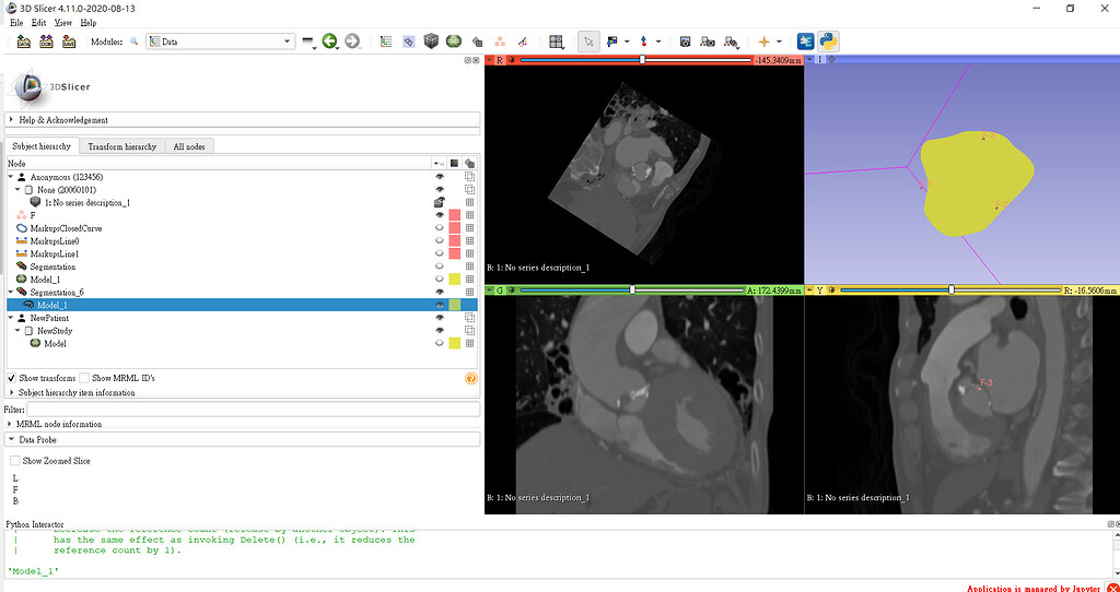 make segmentation labelmap from markupsclosedcurve - Support - 3D Slicer Community