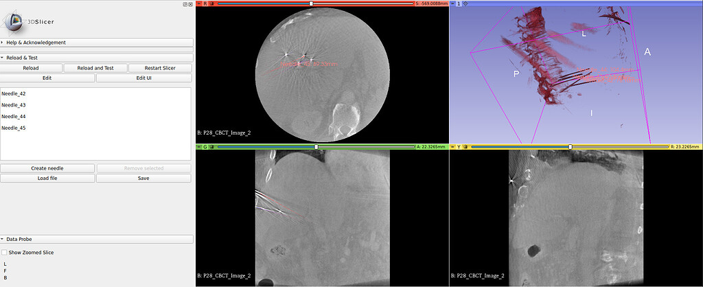 Create/draw line markup from scripted module - Support - 3D Slicer Community