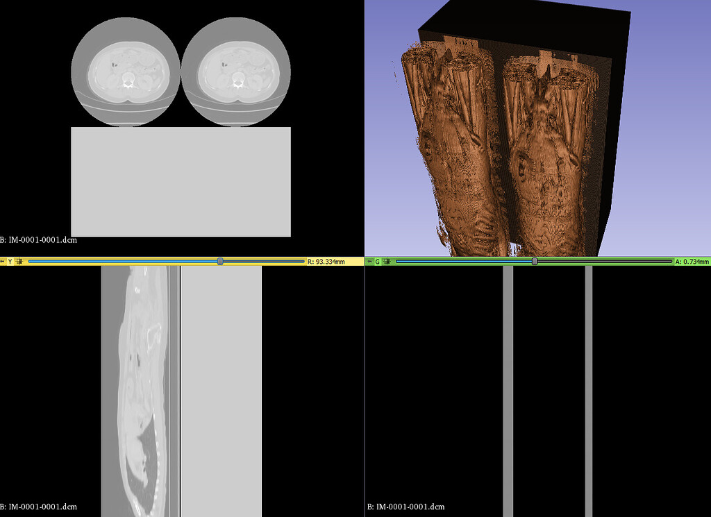 Odd DICOM import - Support - 3D Slicer Community