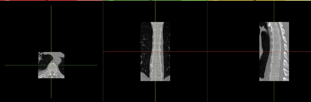 How to display the cropVolume fitted with the slice views? - Support ...
