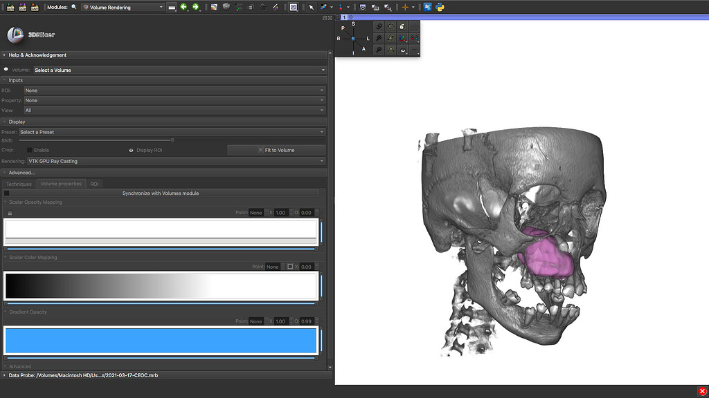 Prism rendering - Support - 3D Slicer Community