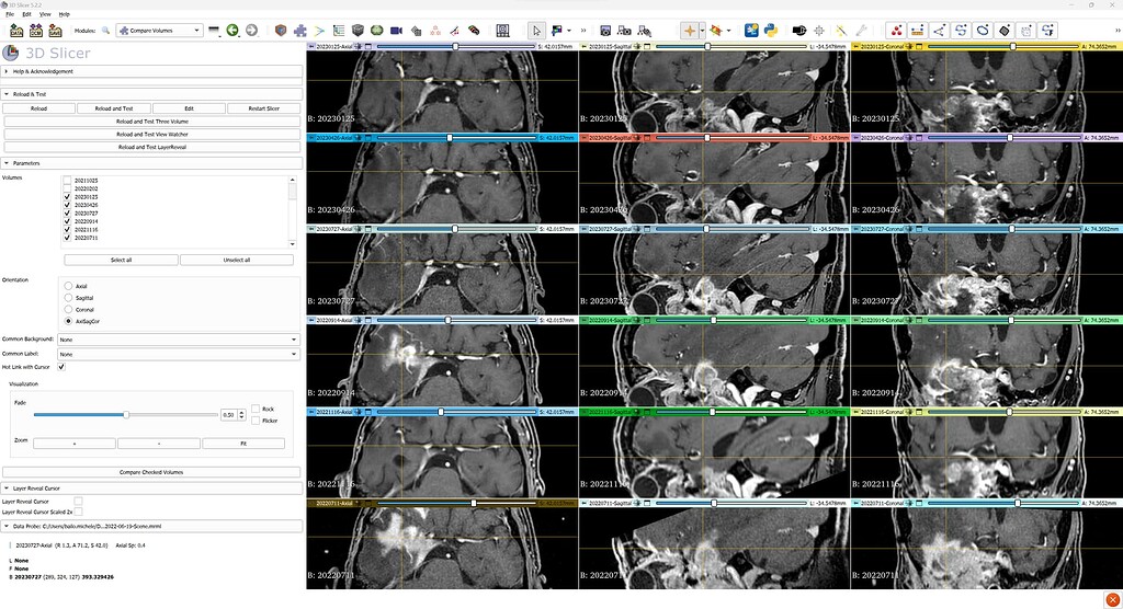 "Compare Volumes" module - display order - Feature requests - 3D Slicer Community