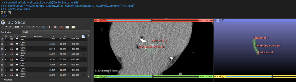 Extract Centerlines Issue - Support - 3D Slicer Community
