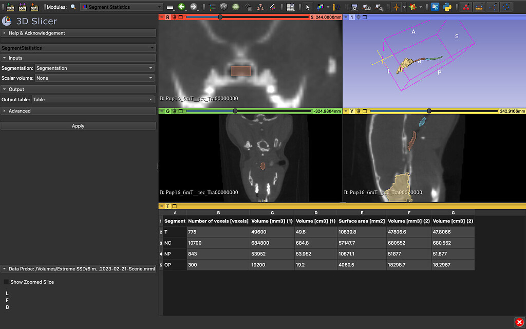 Two different volumes of the same segment - Support - 3D Slicer Community