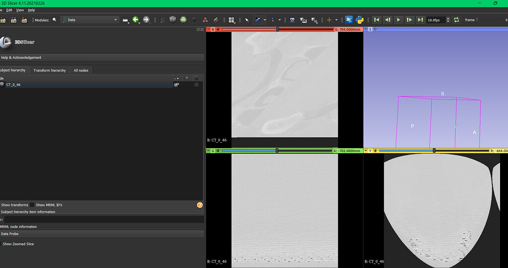I can’t normally open a volume in 3D Slicer scanned with a Morita CT scanner - Support - 3D ...