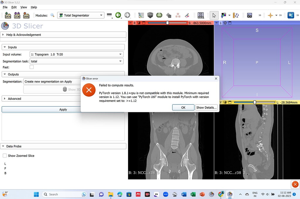 Pytorch extension installation - Support - 3D Slicer Community