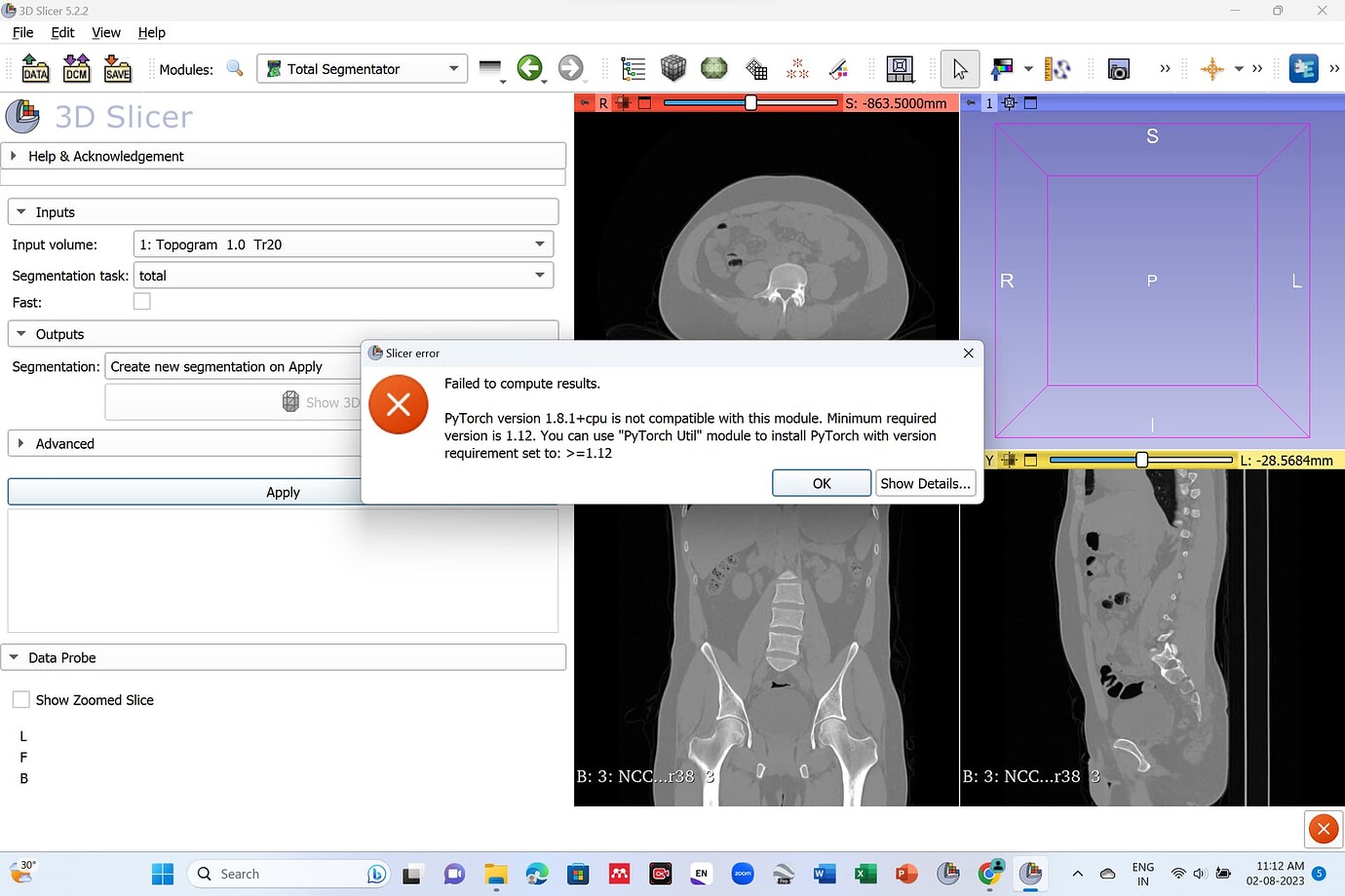 Pytorch extension installation - Support - 3D Slicer Community