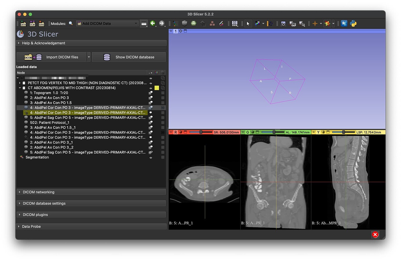 How to display CT images in 3D view - Support - 3D Slicer Community