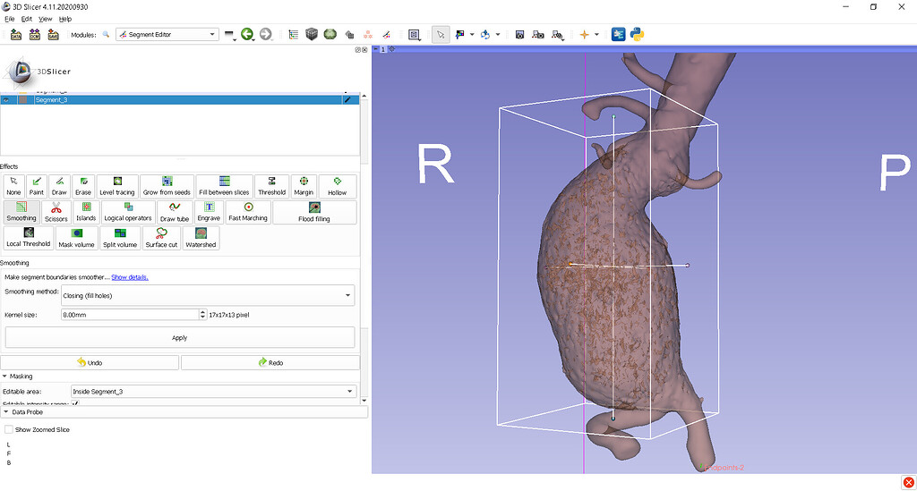 How to fill small holes in segmentations - Support - 3D Slicer Community