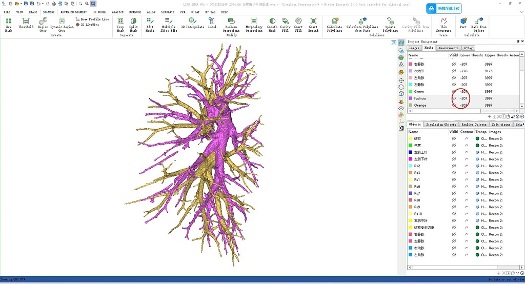 Implement the mask adjustment function based on threshold in mimics in slicer - Feature requests ...