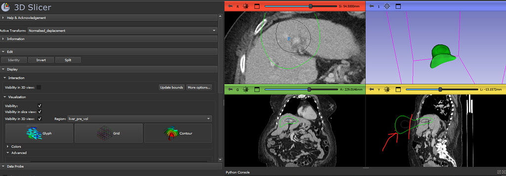Limit a transform display to a region in slice view - Feature requests - 3D Slicer Community