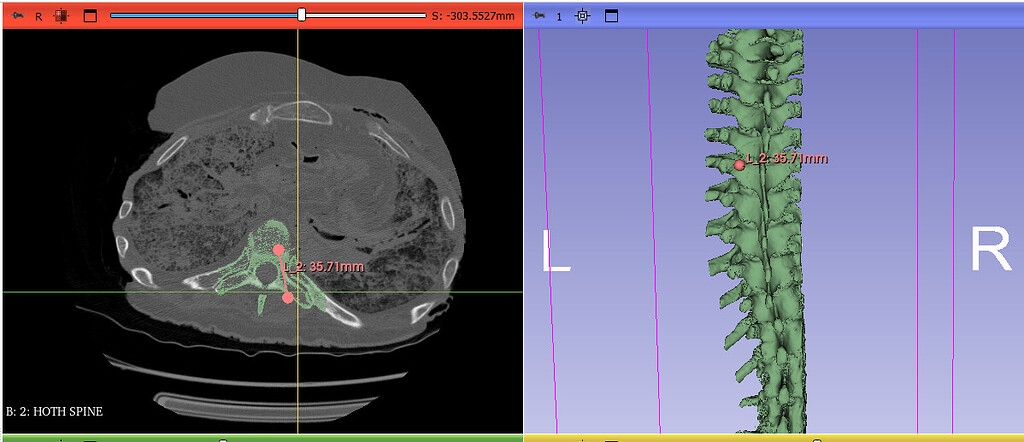 Markups Feature - Support - 3D Slicer Community