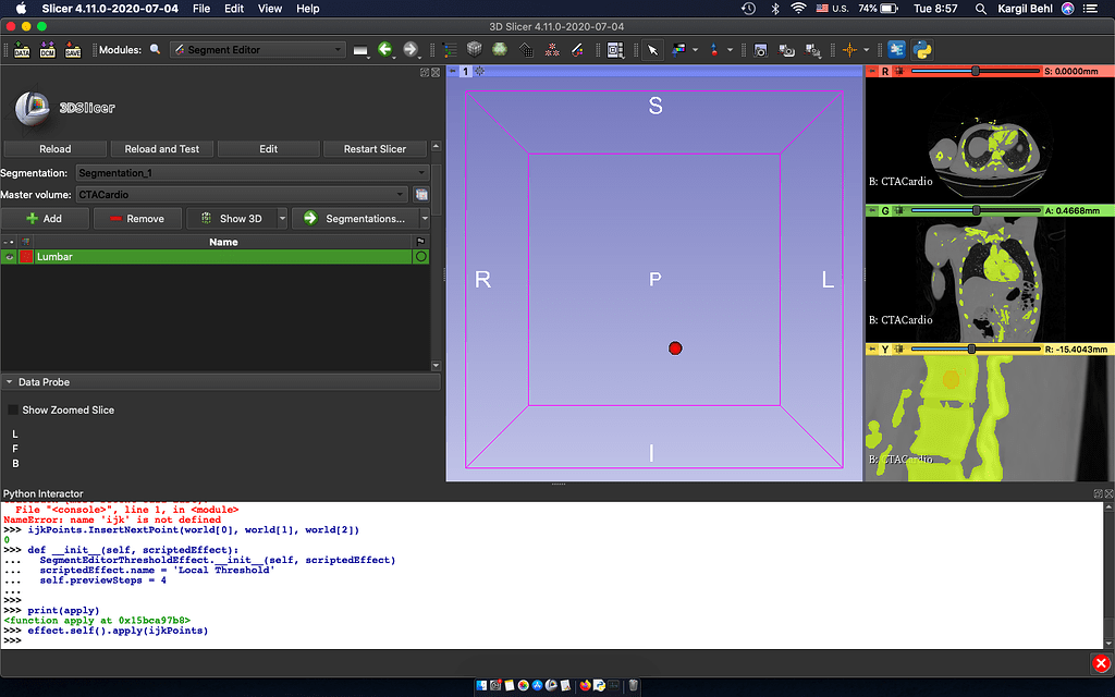 Python Module Logic Class - Development - 3D Slicer Community