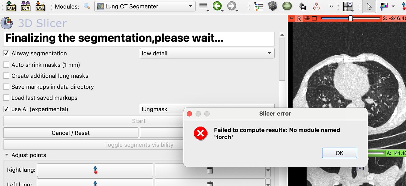 Lung CT Segmenter now supports 'lungmask' AI for lung and lobe ...