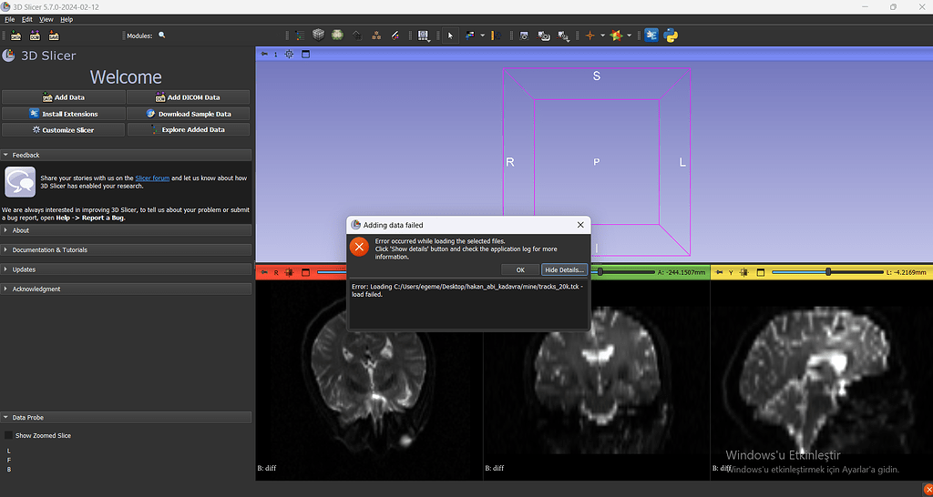Getting error while trying to load tracts - SlicerDMRI - 3D Slicer ... Getting error while trying to load tracts - SlicerDMRI - 3D Slicer ...