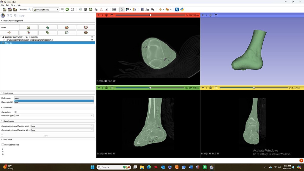 Dynamic Modeler - unable to get tools to display - Support - 3D Slicer Community