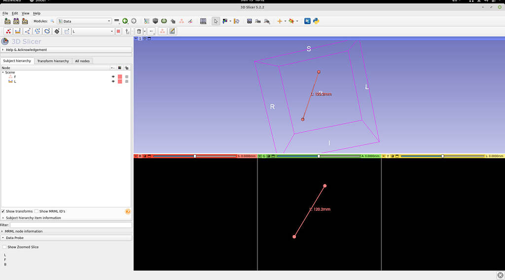 We Assembled A Widget From 3d Slicer In The Browser Development 3d Slicer Community