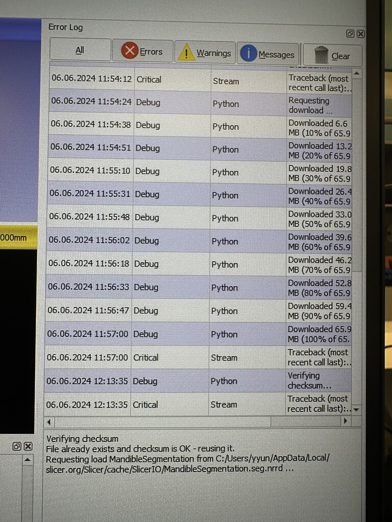 3D Slicer Error - Support - 3D Slicer Community