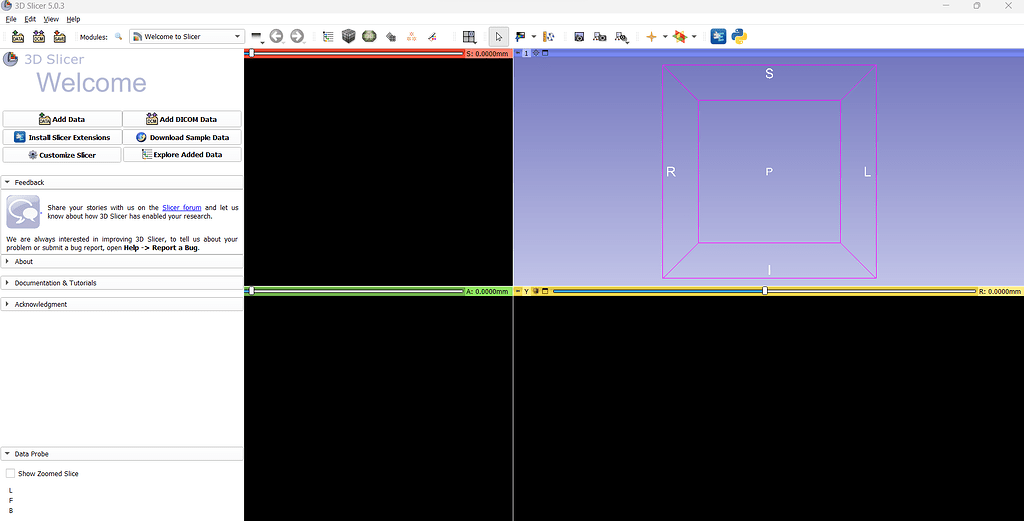 Cannot drag-and-drop segmentation to the application window and unequal view width on Windows11 ...