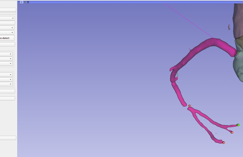 Automate extract centerline with unconnected segment - Development - 3D Slicer Community