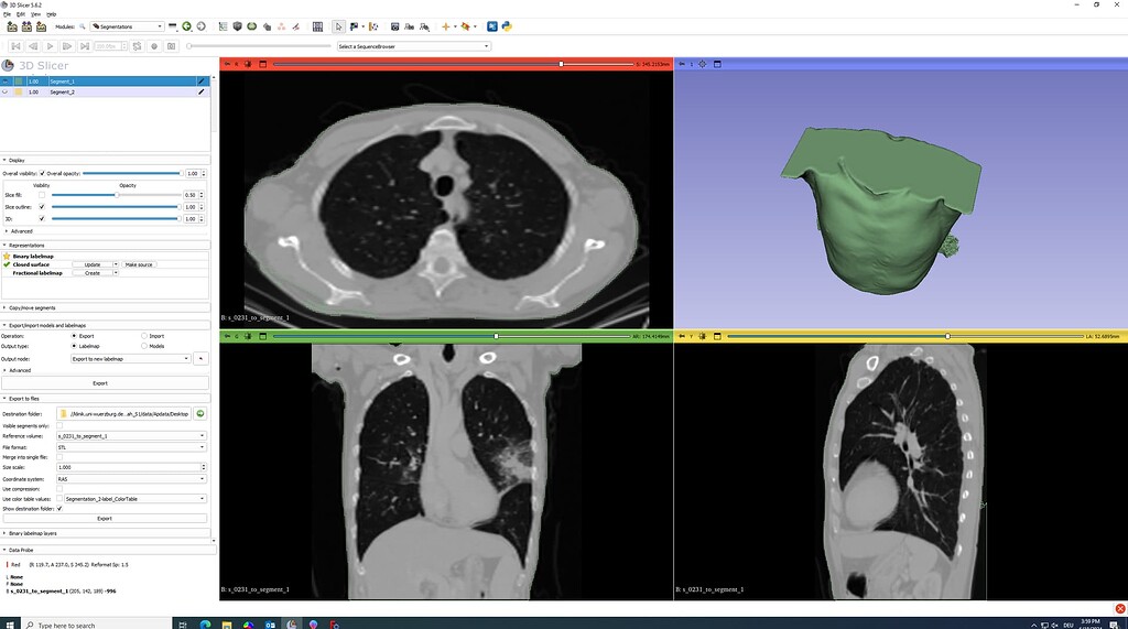 Segmentation of skin - Support - 3D Slicer Community