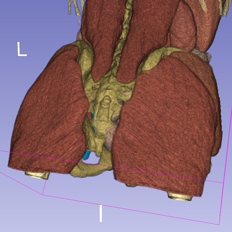 VTK multivolume/cinematic volume rendering - Support - 3D Slicer Community