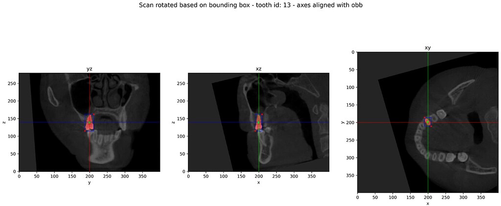 How to leverage oriented bounding boxes from SegmentStatistics to crop scans within python numpy ...