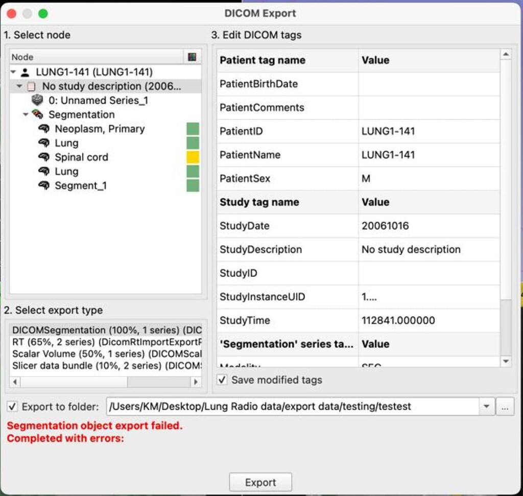 Unable to export segmentation object - Support - 3D Slicer Community