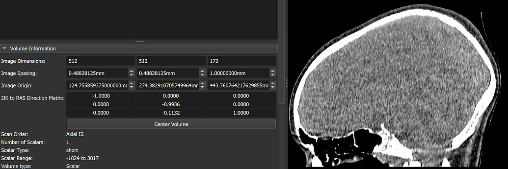 Non Orthogonal Ijk To Ras Direction Matrix Support 3d Slicer Community