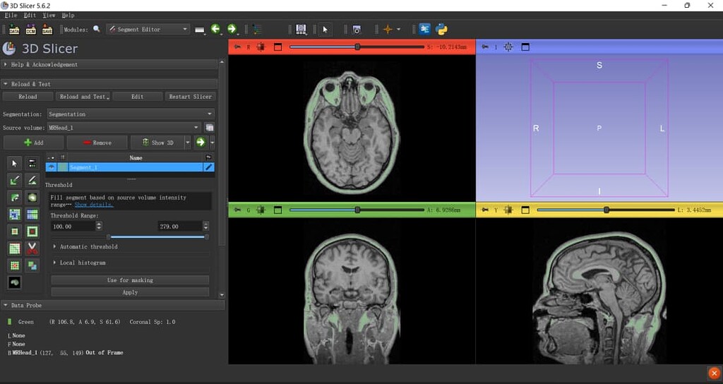 How to Modify the Default Threshold Values in Segment Editor for Custom Segmentation? - Support ...