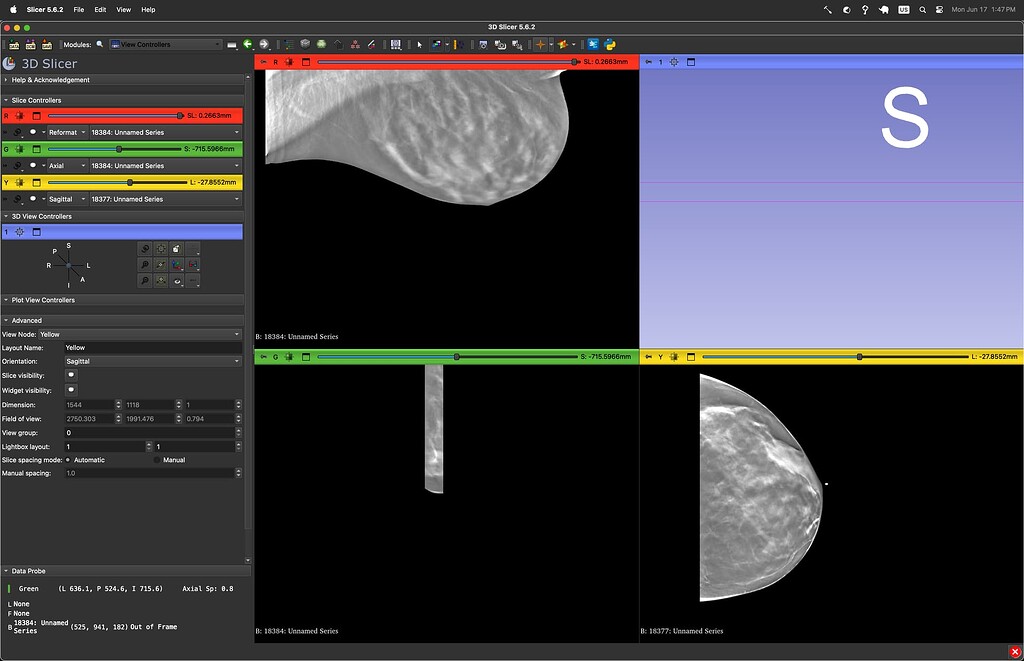 Resizing Window/Viewport - Support - 3D Slicer Community