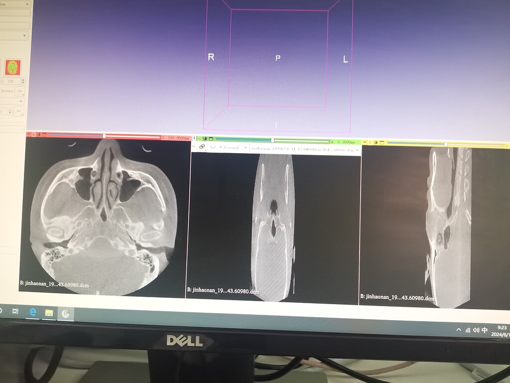 Open .dcm file fail - Support - 3D Slicer Community