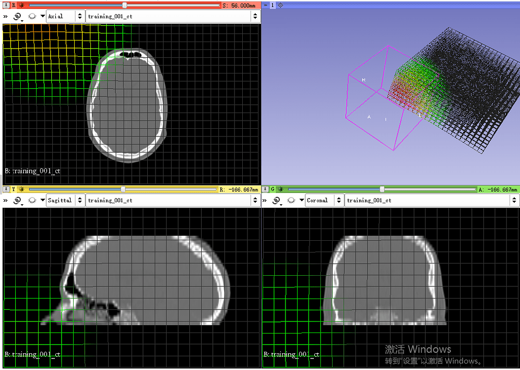 How To Apply A Bspline Transformation Fieldproduced By A Registration To Another Volume Image