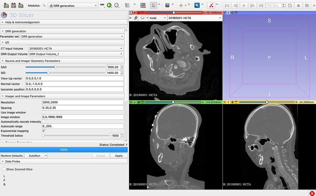 SlicerRT DRR generation module does not work well on macbook - Support - 3D Slicer Community