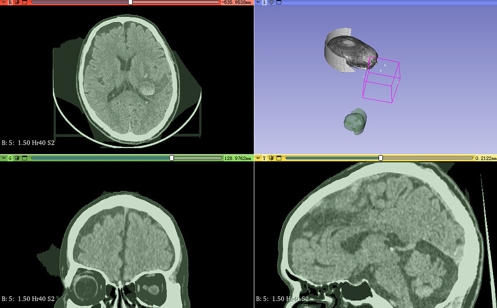 Non Linear Transformation Is Ignored In Volume Rendering Feature Requests 3d Slicer Community