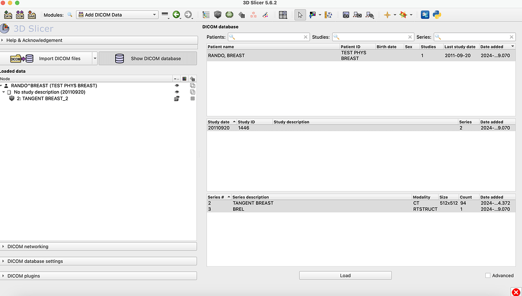 Cannot load RTSTRUCT file - Support - 3D Slicer Community Cannot load RTSTRUCT file - Support - 3D Slicer Community